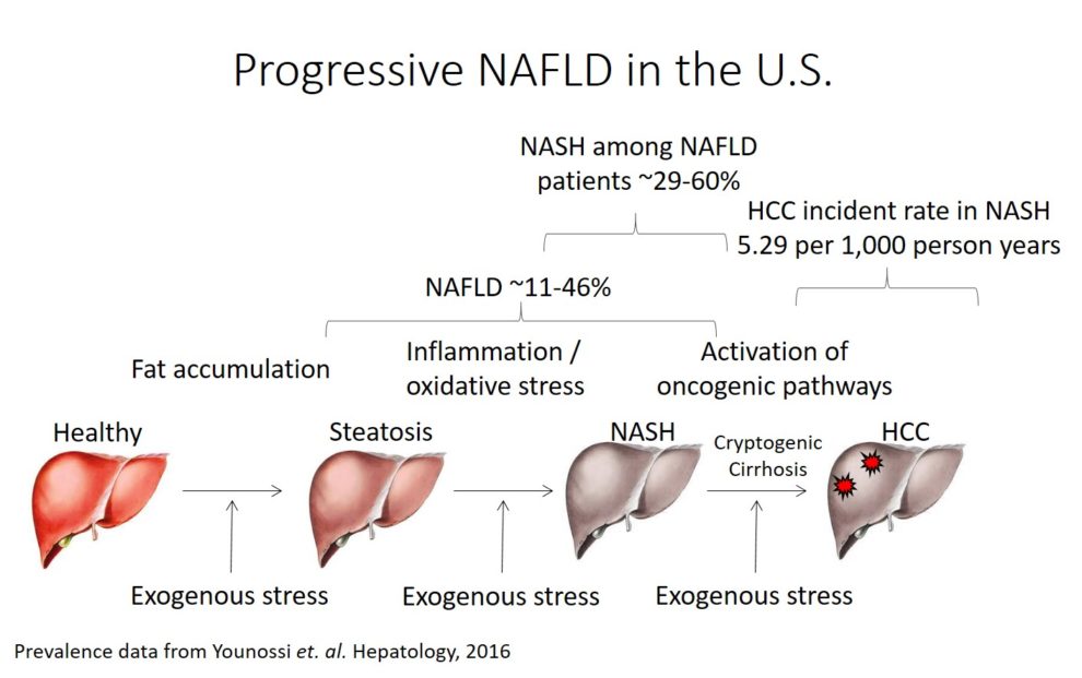 Research in Toxicities in NAFLD | John Clarke Lab | Washington State ...