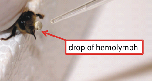 How are the insides of an insect different from a human? | Ask Dr ...