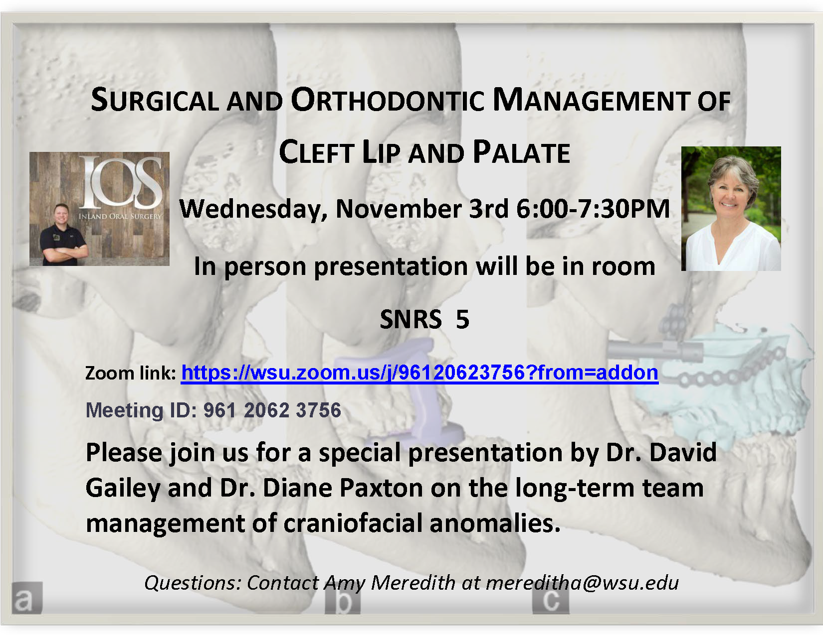 Orthodontics Cleft Lip Palate Management at Aida Arnold blog