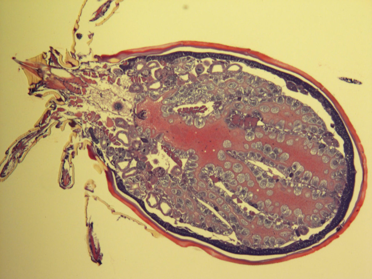 The secrets in a tick’s gut – WSU Insider