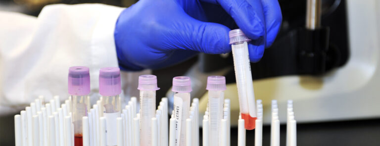 Clinical Pathology | Veterinary Teaching Hospital | Washington State ...