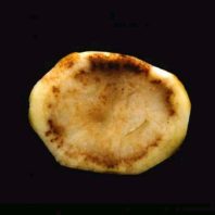 Potato Diseases | Department of Plant Pathology | Washington State ...