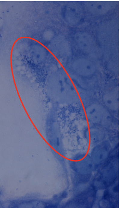 Piscirickettsia salmonis, “Piscirickettsiosis” | Washington Animal ...