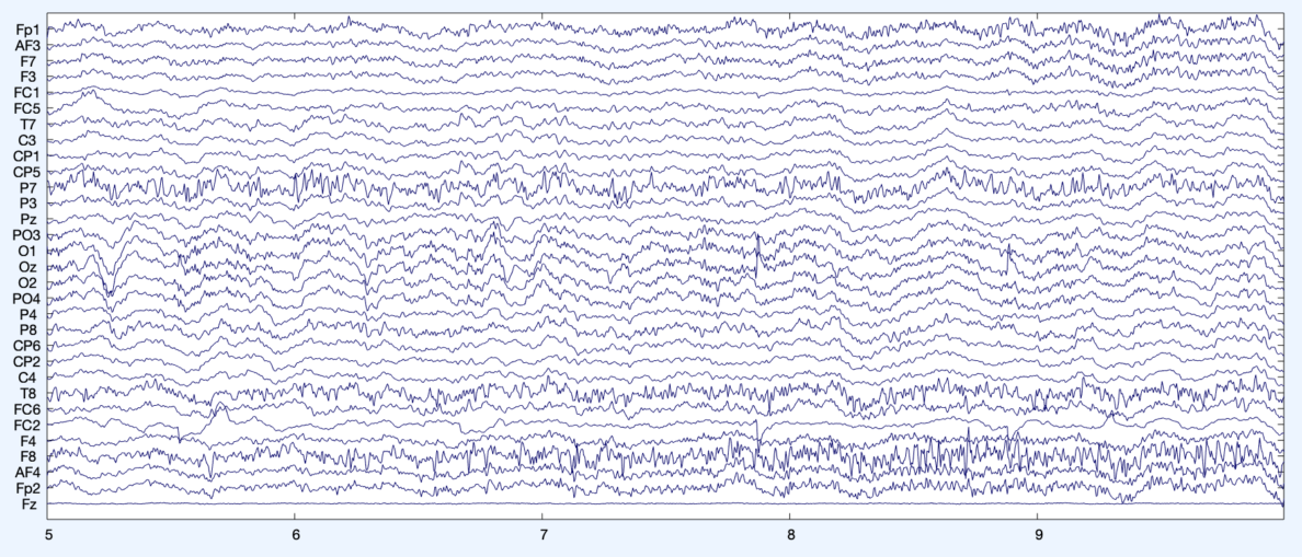 Baby EEG Project | Gartstein Temperament Lab | Washington State University