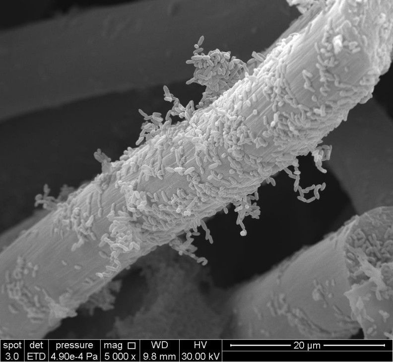 Emily Davenport wins two awards at the Inland Northwest Micrograph ...