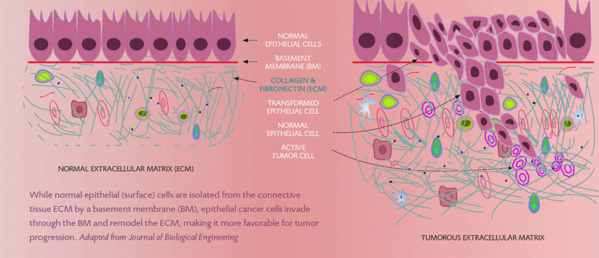 A new dimension to fighting cancer | Washington State Magazine ...
